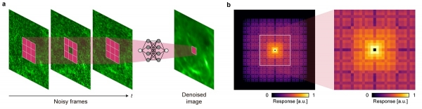 KAIST, 10배 이상 생체신호 정밀 측정 ‘SUPPORT’개발